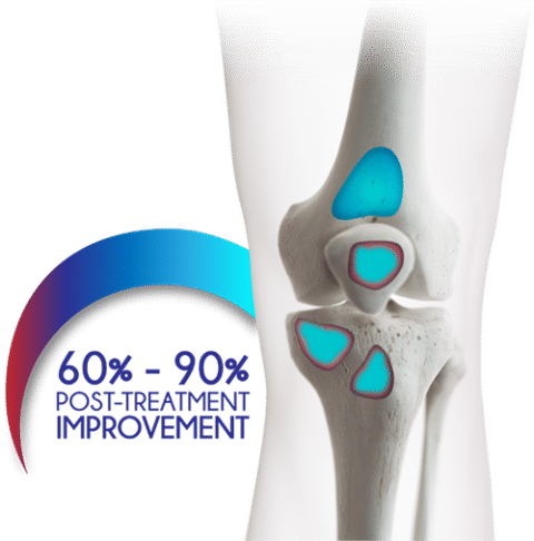 Pain Bursitis - Knee Pain Doctors in New Jersey